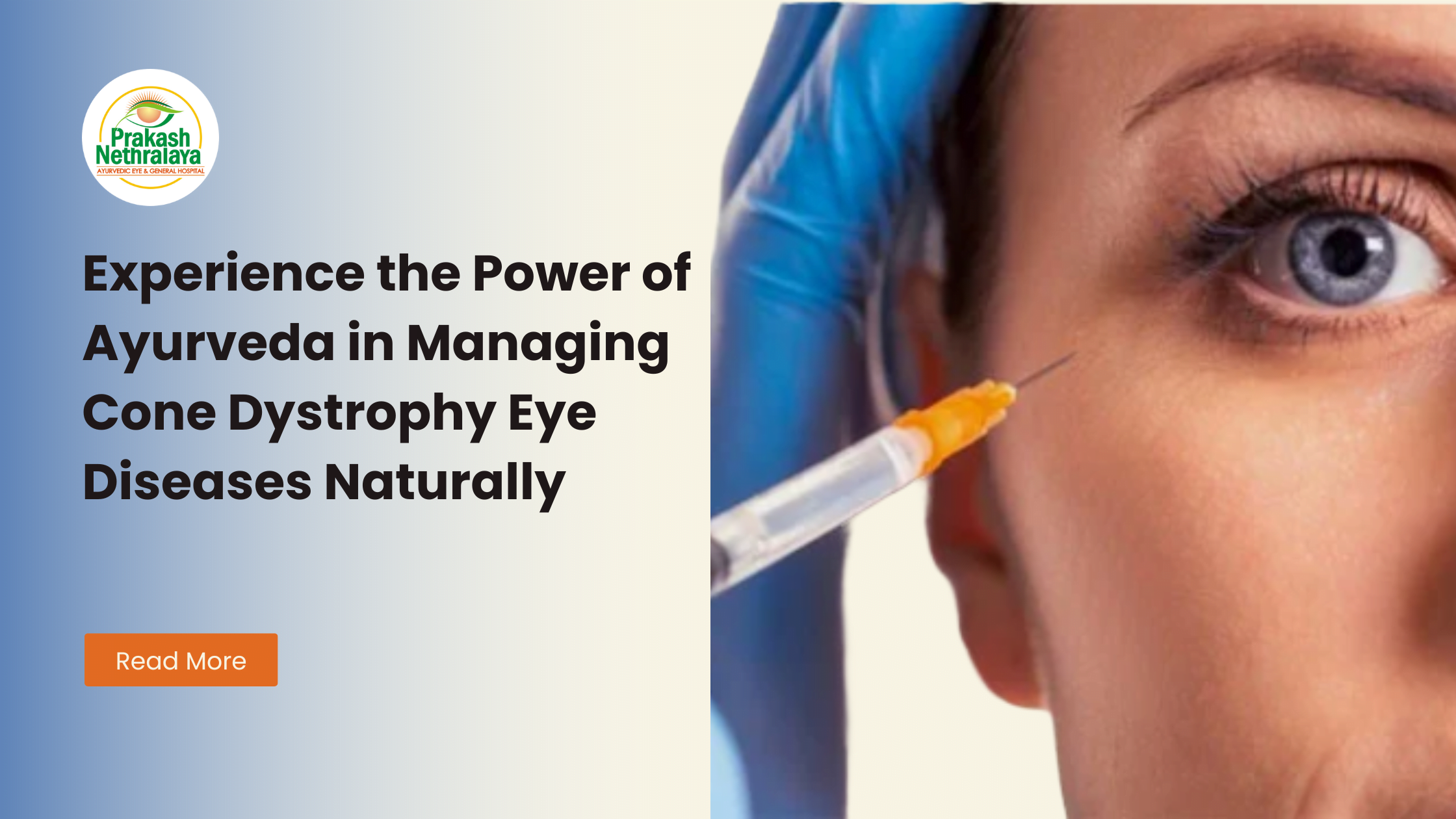 Ayurvedic Management of Cone Dystrophy Eye Disorder