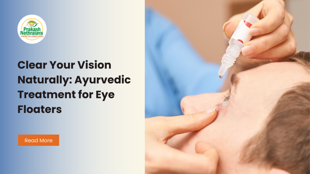 Clear Your Vision Naturally: Ayurvedic Treatment for Eye Floaters